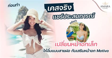 Motiva Ergonomix เป็นซิลิโคนที่นิ่มที่สุดจริงไหม