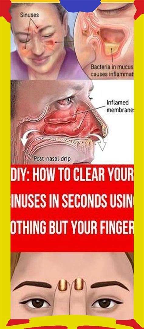 How To Clear Your Sinuses In Seconds Using Nothing But Your Fingers Sinusitis Mucus Sinus