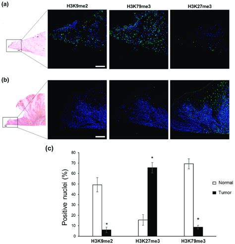 Immunofluorescence Analysis Of H3 Modifications In Head And Neck
