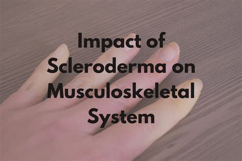 How Scleroderma Affects Musculoskeletal System Dr Badhan