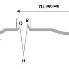 ECG Representation And QT Interval Download Scientific Diagram