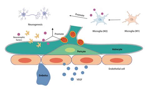 Brain Remodeling In Stroke Patients A Comprehensive Review Of