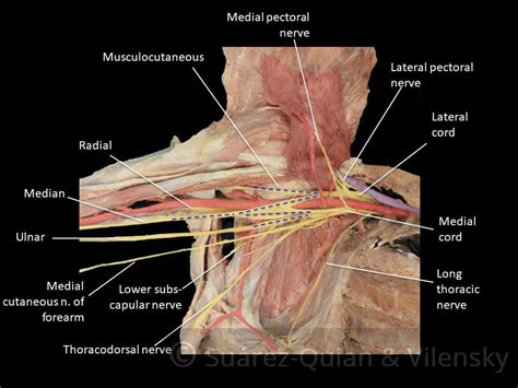 The Brachial Plexus Sections Branches Teachmeanatomy