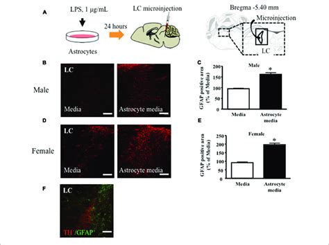 Lipopolysaccharide Lps Treated Astrocyte Conditioned Medium