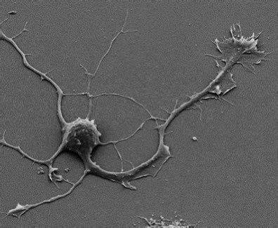 Neuron Cell Electron Microscope Neurotransmitter Classification From