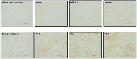 Immunocytochemical Detection Of Ne Induced Sglt1 Expression In Hk2