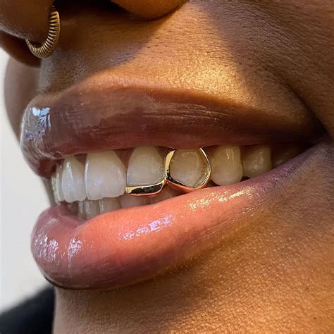 Pin De Scarlett Carver Em Jewellery Dentes Grillz Grills Dentes