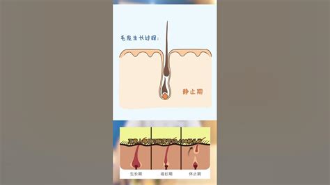 【脫髮常識】每天掉多少頭髮才算正常？了解生長原理，正確判斷脫髮情況！ 植髮醫生續開聰 Youtube