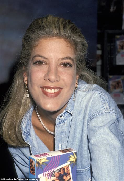Tori Spelling Reveals Tooth Was Chipped During Makeout Session With