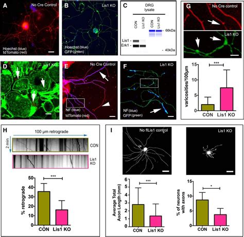 An Essential Postdevelopmental Role For Lis In Mice ENeuro