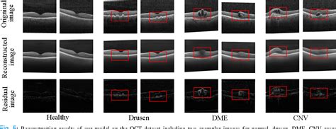 Figure From Anomaly Detection For Medical Images Using Self Supervised And Translation