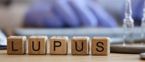 Novel Biomarkers Identified For Lupus Nephritis Bioanalysis Zone