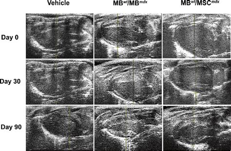 Confirmation Of Reduced Cardiac Disease In Mdx Mice At 90 Days After