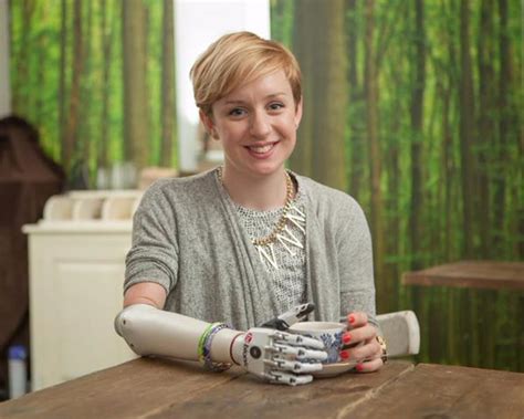 British Woman Receives First Bebionic Hand Designed For Women And Teens