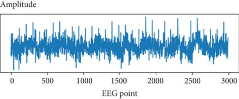 Output Results Of The First Convolution Layer In Cinc2018 Dataset A Download Scientific