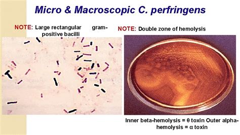 Practical No 14 Genus Clostridium Genus Clostridia G