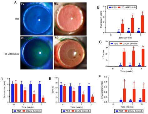 Alterations To The Ocular Surface And Degree Of Inflammation Following Download Scientific