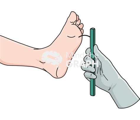 Free Monofilament Test 2 Icons Symbols Pictures And Images Mind The Graph