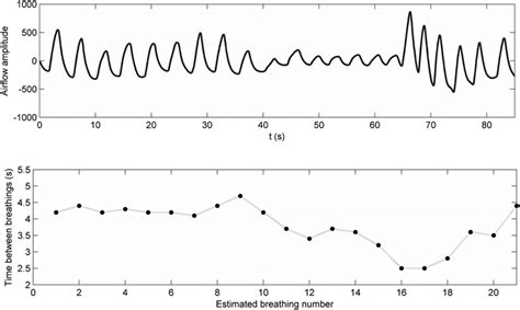 Normal Breathing Pattern Followed By Hypopnoea Event In A Af Signal