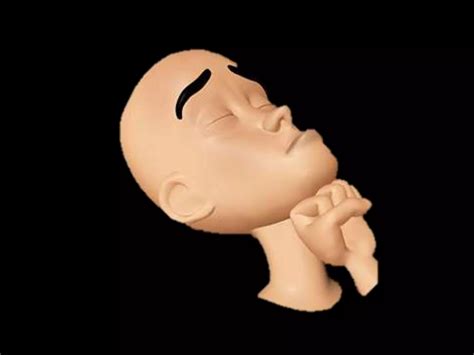 Jaw Dislocation Pptx