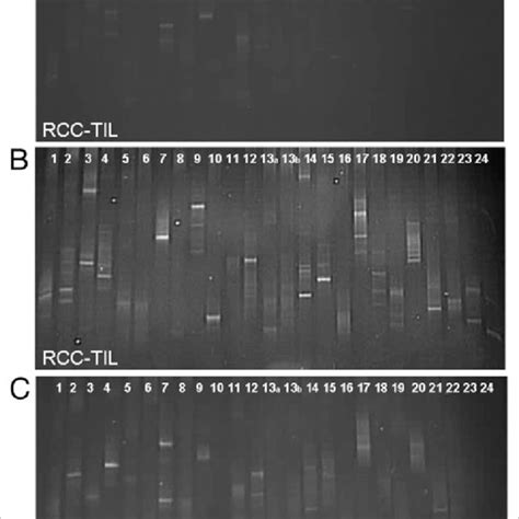 Comparative Tcr Clonotype Mapping Reveals Common T Cell Clones In The