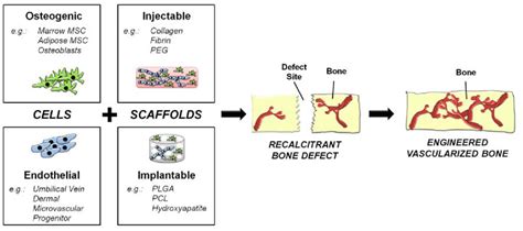 Figure 1 From Cell Based Approaches To The Engineering Of Vascularized