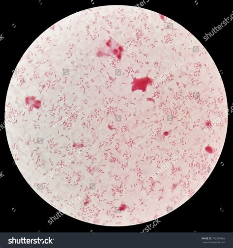 Gram Negative Bacilli 100x