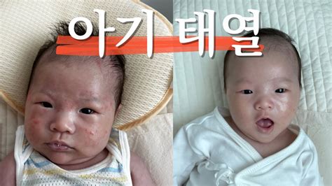 👶🏻 육아 Vlog 신생아 아기 태열 로션 제품 추천 수면 환경 쿨리베어 옆잠베개 머미쿨쿨 수딩젤 란시노크림 Youtube