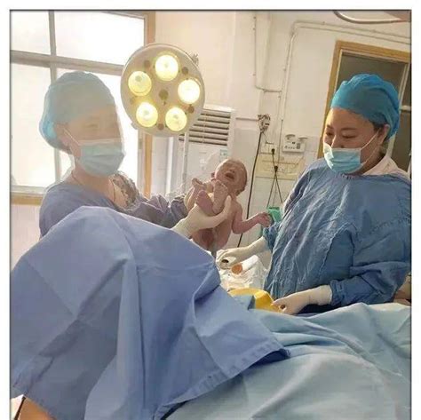 臀位外倒转术背后的故事伍女士郭屹顺产