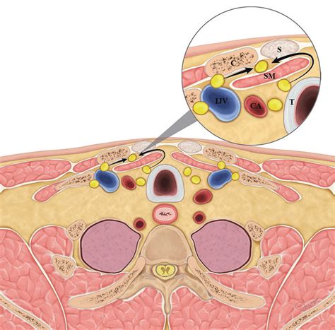 Schematic Illustration Of Two Pathways For Suprasternal Lymph Node Download Scientific Diagram