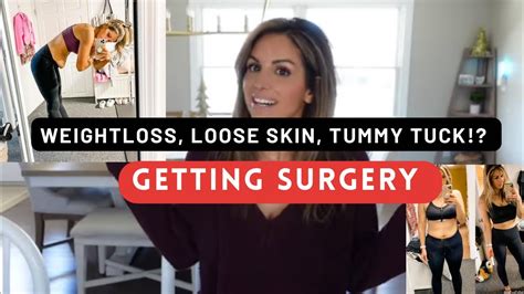 Big News Tummy Tuck 70lb Weightless Journey Loose Skin Stretch