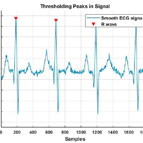 A Sample Of R Wave Detection By Applying The Pick Detection Algorithm