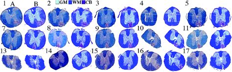 Histology Segmentation Shown Are The Original Histological Images A Download Scientific