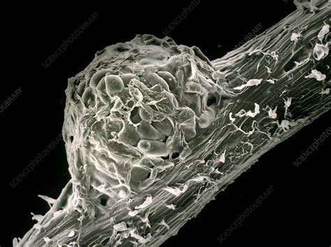 Sem Of Root Nodule On The Pea Plant Stock Image B238 0013 Science Photo Library