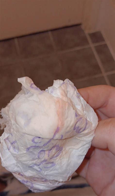 Is This Implantation Bleeding Or Ovulation Bleeding Cw Pic R