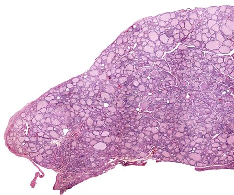 Thyroïde Follicules Image Stock Image Du Hormone Tissu 93292489