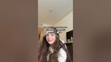 Genmutation⁉️😳🐄 Piebaldism Girl Genetics Youtube