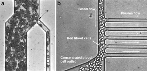 Cell Sorting Techniques A Review Of Label Free Methods Elveflow