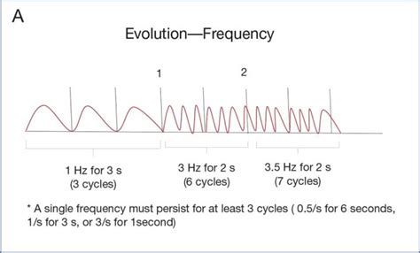 Periodic And Rhythmic Patterns In The Pediatric Icu Neupsy Key