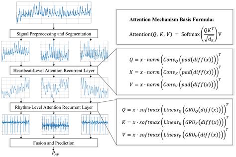 Artificial Intelligence Based Atrial Fibrillation Recognition Method For Motion Artifact