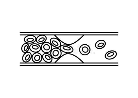 Deep Vein Thrombosis Dvt Artery And Vein Disease With Fat Cells Line