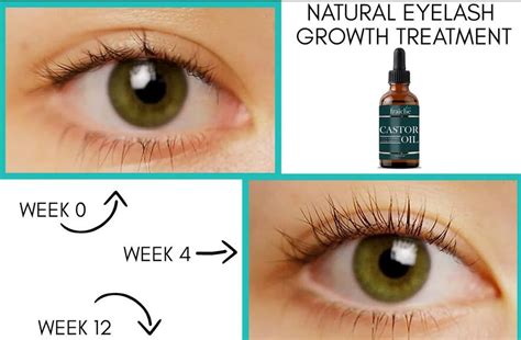 14 Benefits Of Castor Oil For Eyelashes And How To Use It