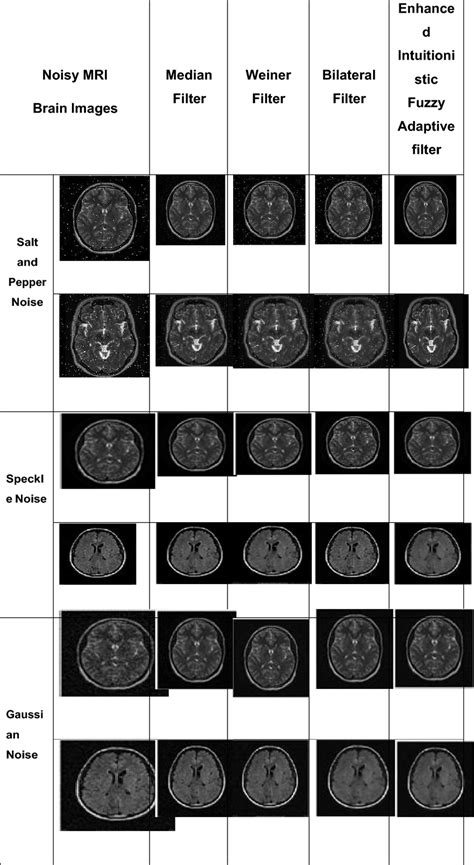 Comparison Of De Noised Brain Mri Download Scientific Diagram