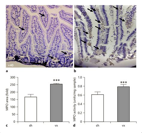 Immunohistochemistry Staining For Mpo Detection In The Small Intestines Download Scientific