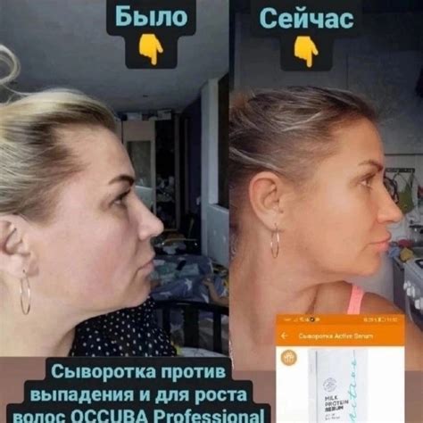 ‼️‼️‼️НОВЕНЬКИЕ ОТЗЫВЫ НА НАШУ ШИКАРНЕЙШУЮ СЫВОРОТКУ ДЛЯ ВОЛОС‼️‼️‼️ ВКонтакте