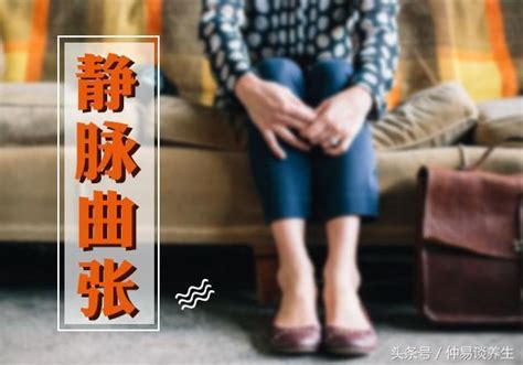 中医中药针灸有效治疗静脉曲张 知乎