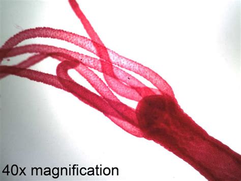 Budding Hydra Microscope