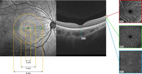 Segmentation Of The Macular Subregions Structure And Download