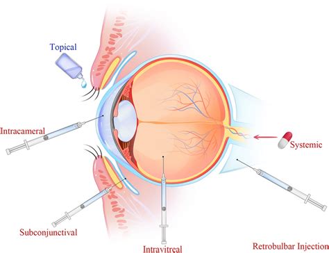 Routes Of Drug Administration For Ocular Delivery They Mainly Contain Download Scientific