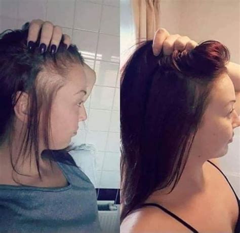 Cesnakový šampón Na Rast Vlasov A Proti Vypadávani